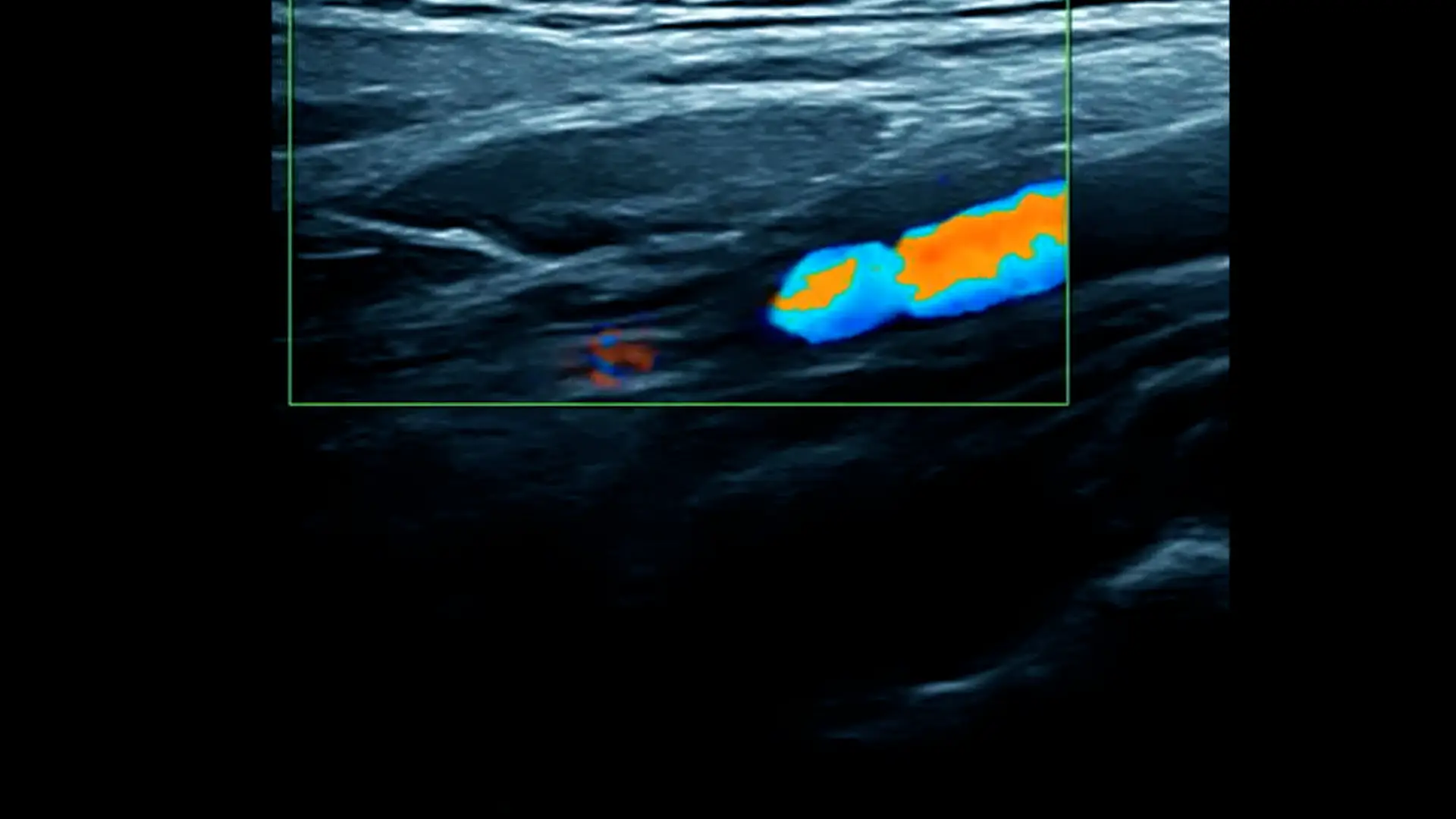 Soft Tissue Ultrasound - The Ultrasound Suite