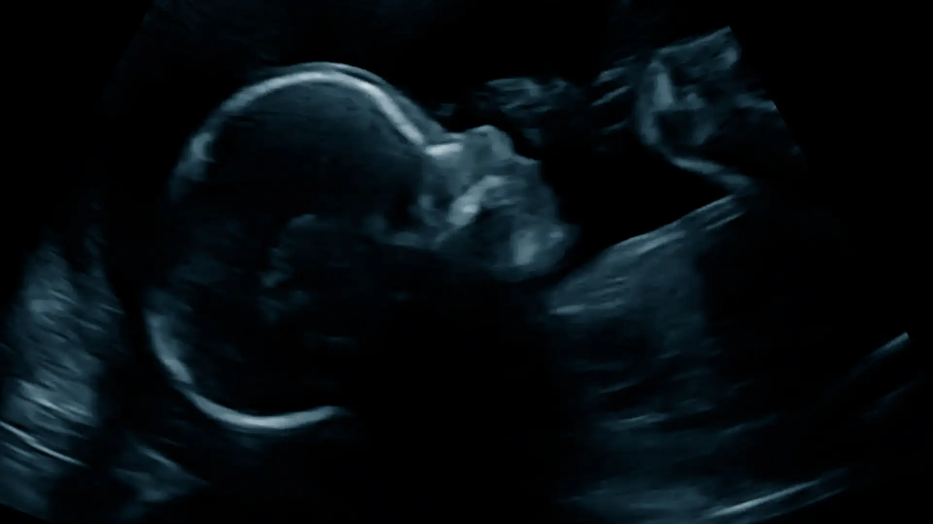 Anomaly Scan - The Ultrasound Suite